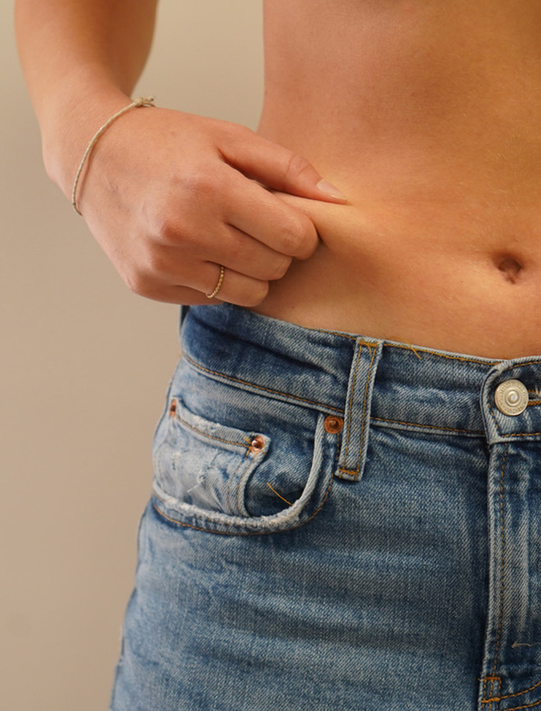 Abdominoplastie et miniabdominoplastie | Docteur Irthum